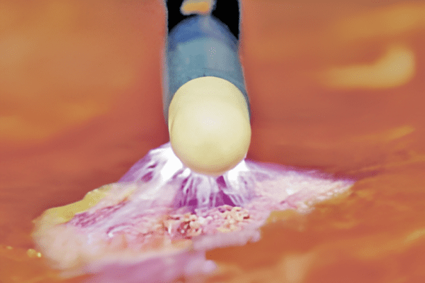 Gastroview – Clínica do Aparelho Digestivo – Atendimento especializado ...